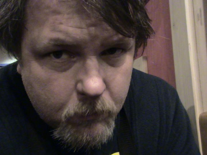 John Hird - Member Profile - Lymphedema Community - Support and ...